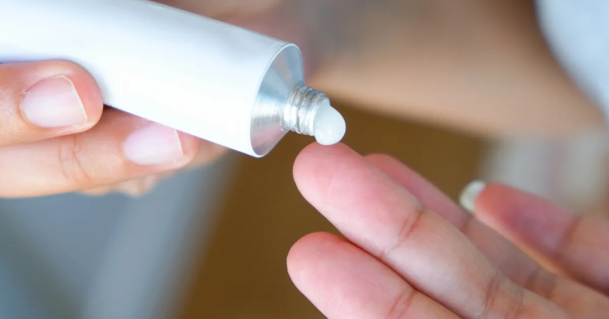 Itchy Bites or Rashes - When Hydrocortisone Cream Can Help