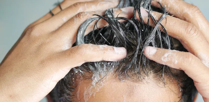 Best Sensitive Shampoo for Scalps | Weldricks Pharmacy